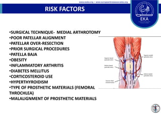RECONSTRUCTION OF EXTENSOR MECHANISM IN TKA | PDF