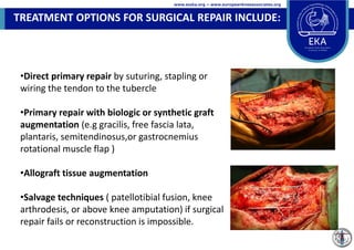 RECONSTRUCTION OF EXTENSOR MECHANISM IN TKA | PDF