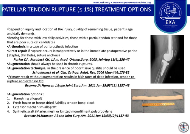 RECONSTRUCTION OF EXTENSOR MECHANISM IN TKA | PDF | Death, Injury, or ...