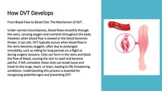 Stay Clot-Free Prevention Strategies for Deep Vein Thrombosis.pptx