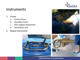Stereotactic brain biopsy | PPTX