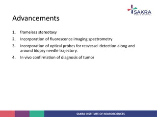 Stereotactic brain biopsy | PPTX