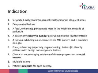 Stereotactic brain biopsy | PPTX
