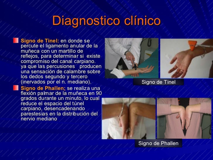 SINDROME DEL TUNEL CARPIANO