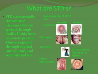 STD | PPT | Free Download
