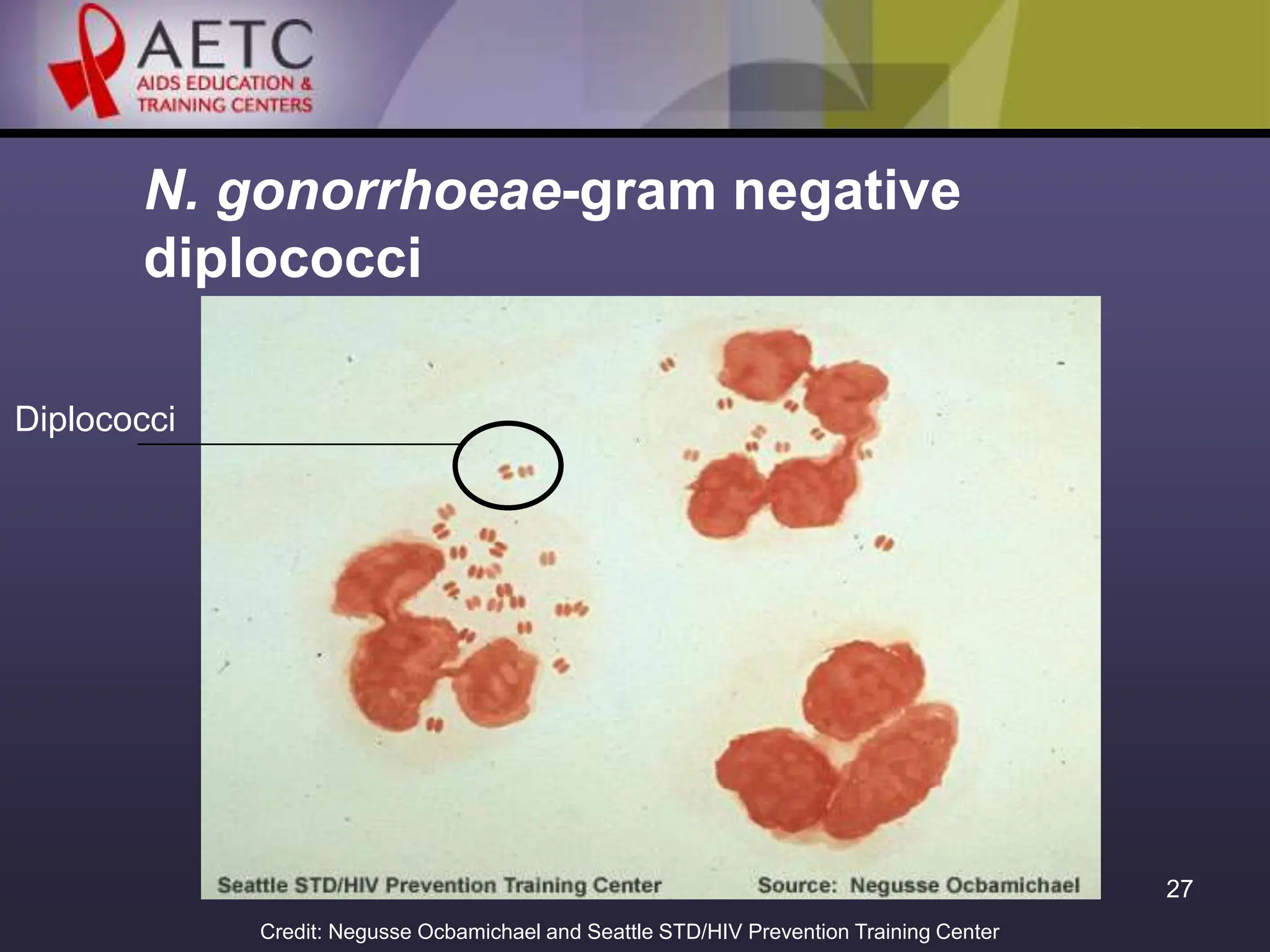 sexually transmitted diseases-module.ppt