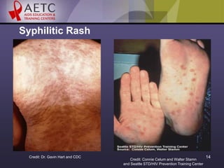 std-module.ppt hhhhhjdddddrssssssssssgfdd | PPT