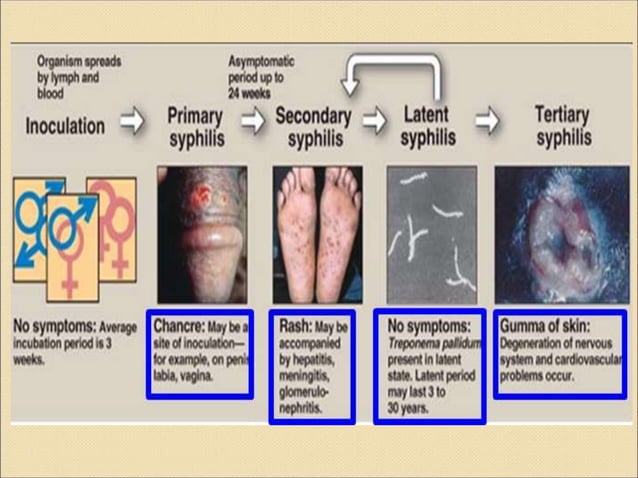 Std syphilis- (1) | PPTX | Infectious Diseases | Diseases and Conditions