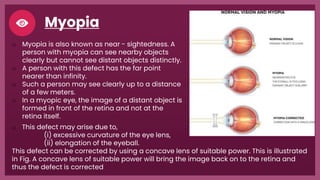 Human eye and Colourful world | Class 10 Physics | TO BUY Contact ...
