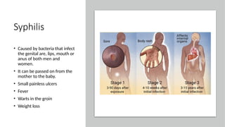 sexually transmitted diseases lesson.pptx