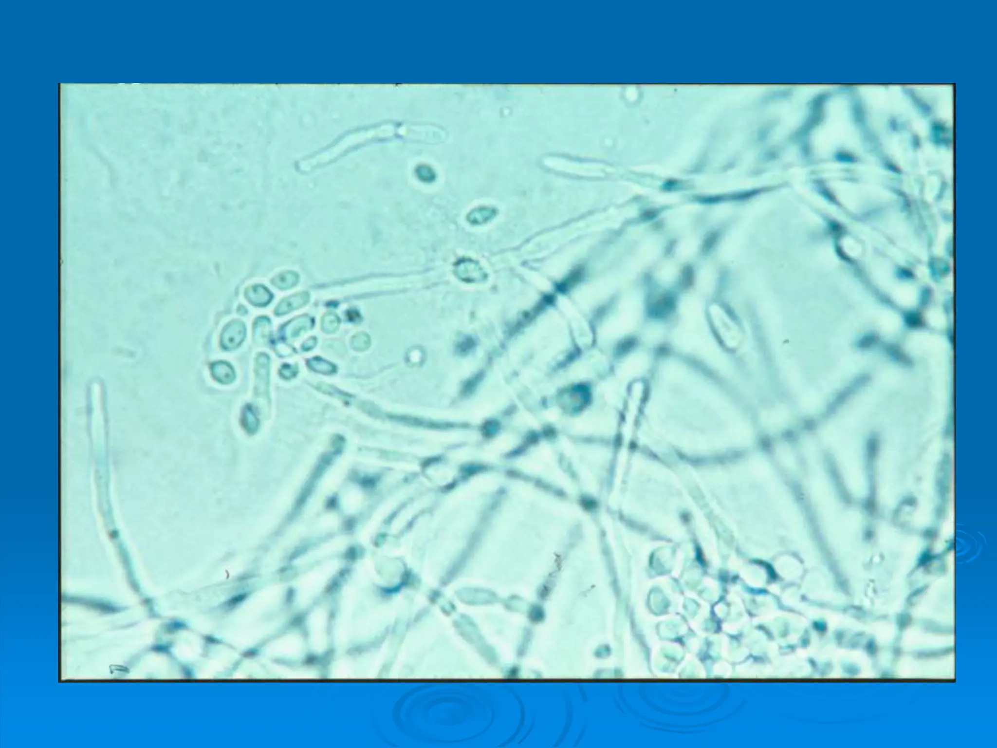 STDs and PID...Obstetrics and gynaecology | PPT