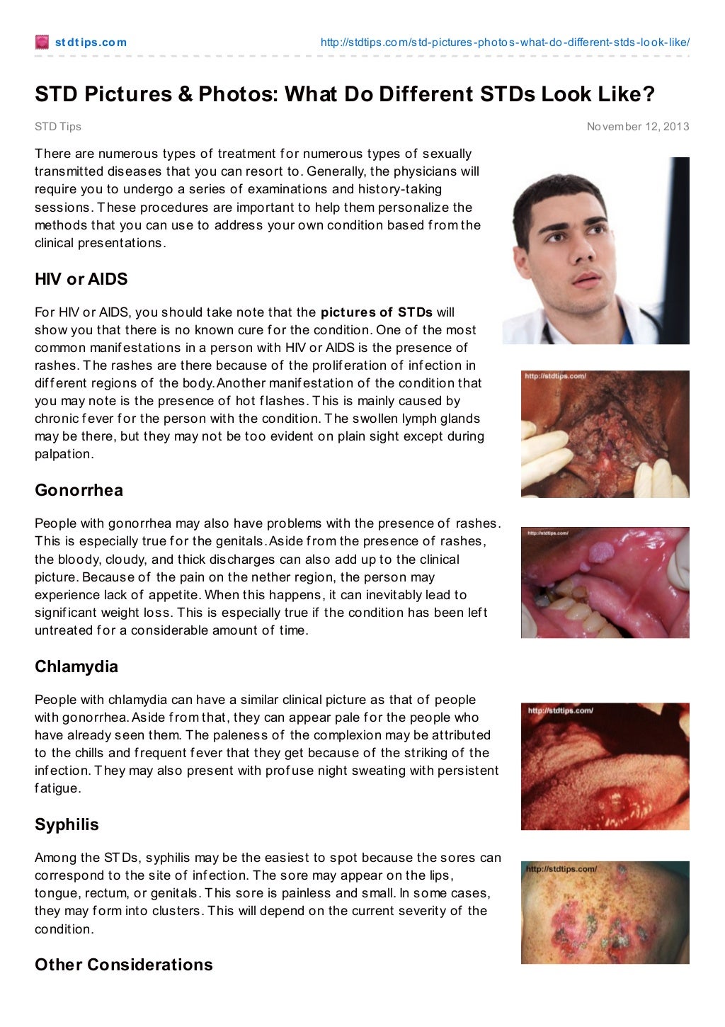 Stdtips.com std pictures-amp_photos_what_do_different_st_ds_look_like