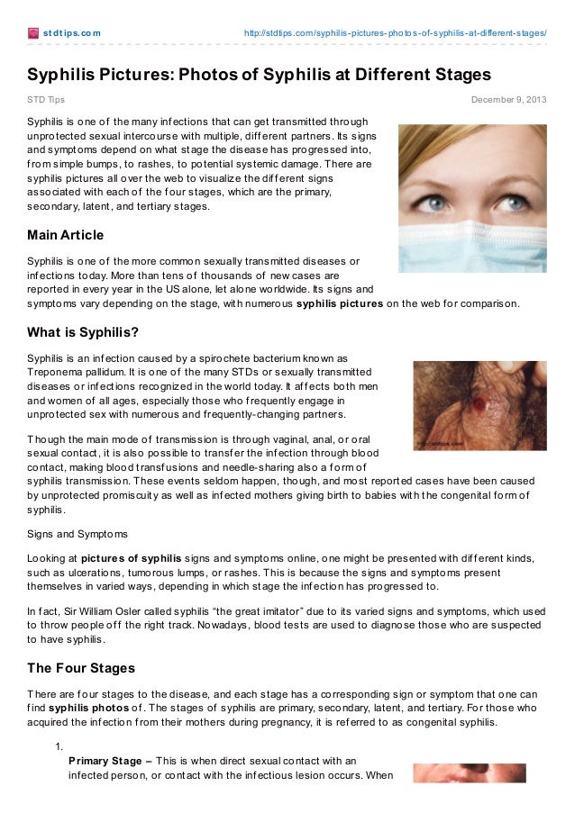 Syphilis Pictures: Photos of Syphilis at Different Stages
