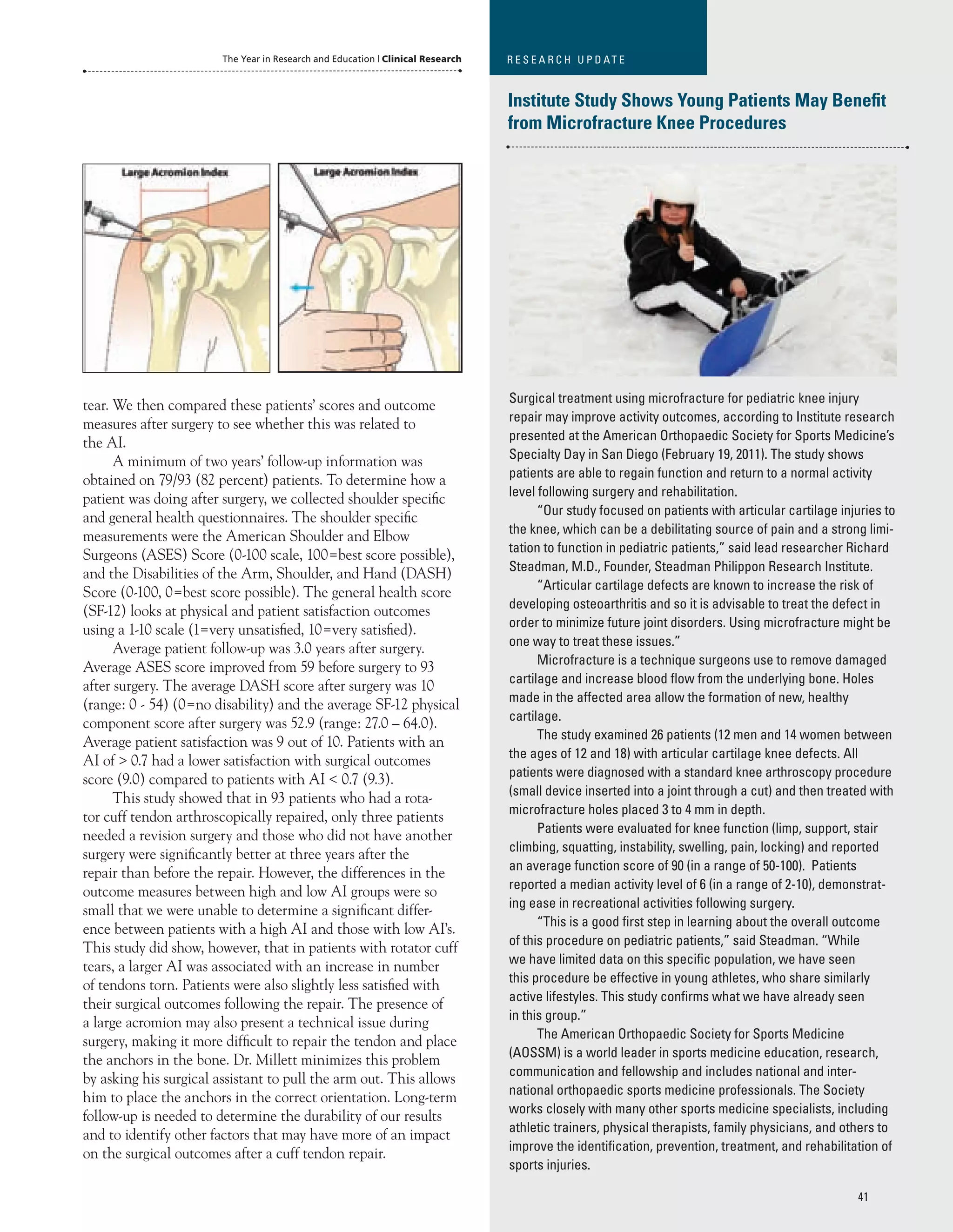 Snapping Scapula Syndrome | Medial Knee Reconstruction | Hip ...