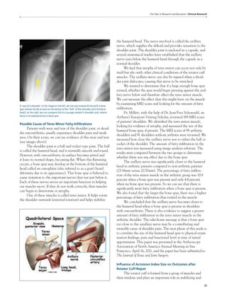 Snapping Scapula Syndrome | Medial Knee Reconstruction | Hip ...