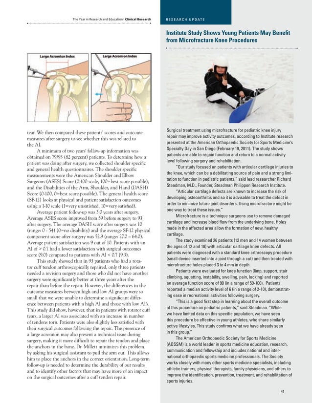 Snapping Scapula Syndrome | Medial Knee Reconstruction | Hip ...