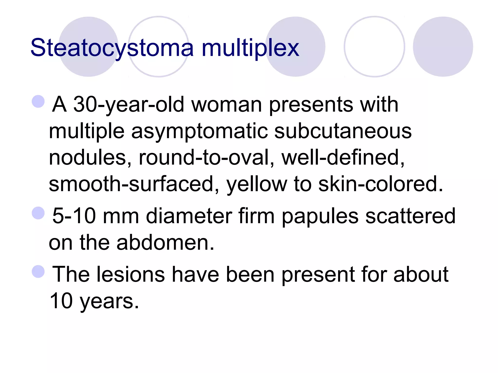Steatocystoma multiplex | PPT