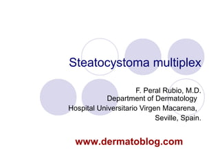 Steatocystoma multiplex | PPT