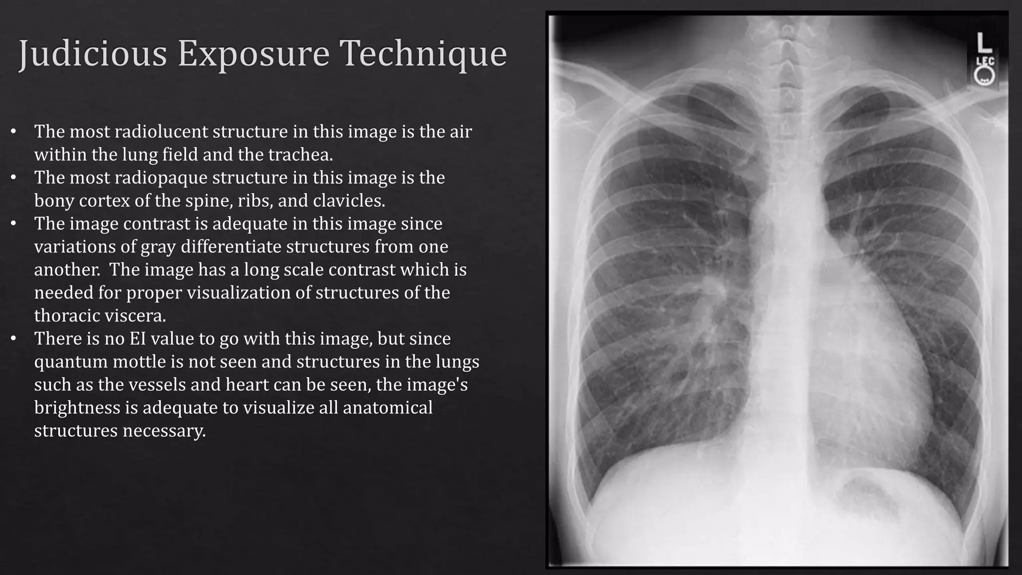 Kristen Steever PA Chest | PPTX