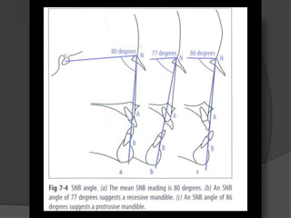Steiner analysis | PPTX