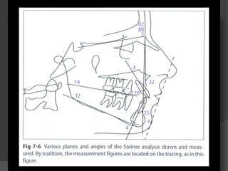Steiner analysis | PPTX