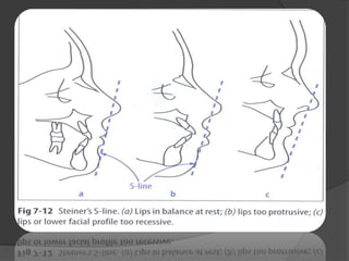 Steiner analysis | PPTX