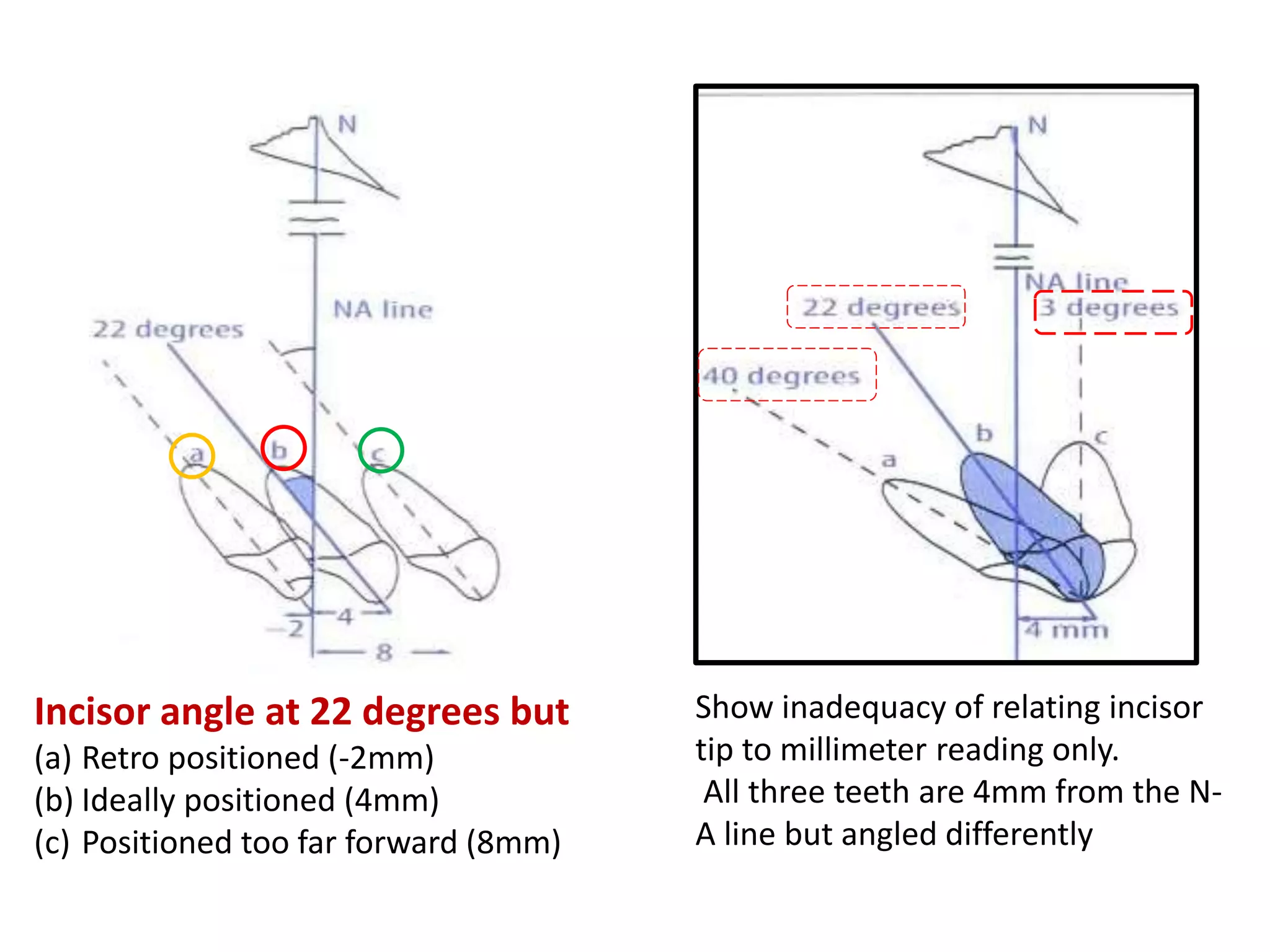 Steiner analysis | PPTX