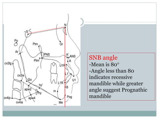 Steiner analysis | PPTX