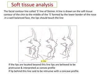 Steiner analysis | PPTX