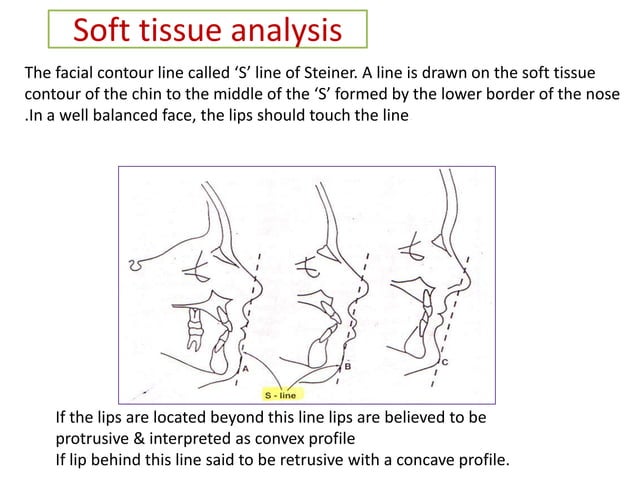 Steiner analysis | PPTX | Dental Health | Diseases and Conditions