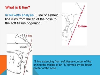 Steiner analysis | PPTX