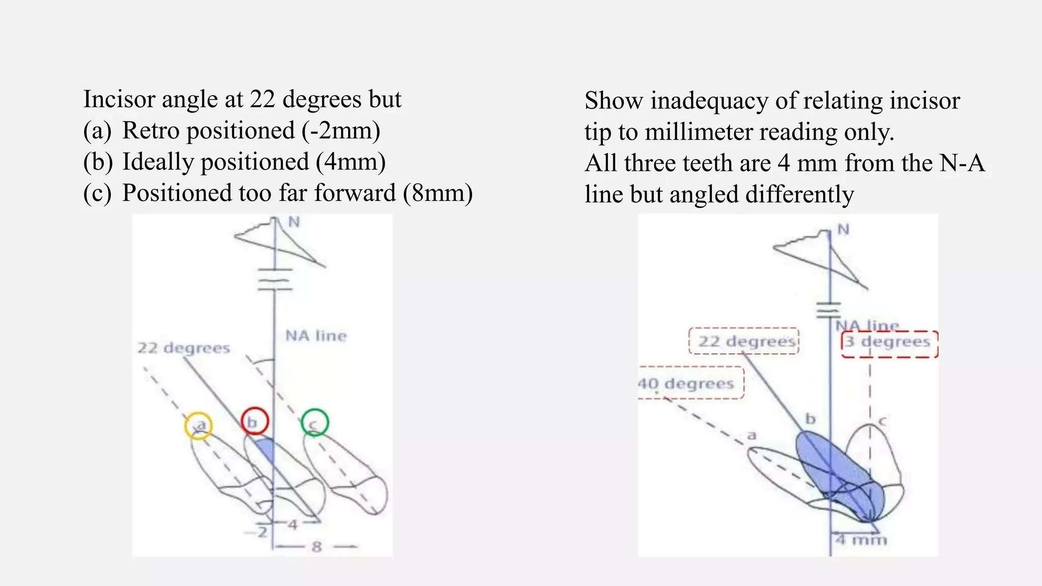 Steiner analysis in orthodontics (Nay Aung, PhD).pdf