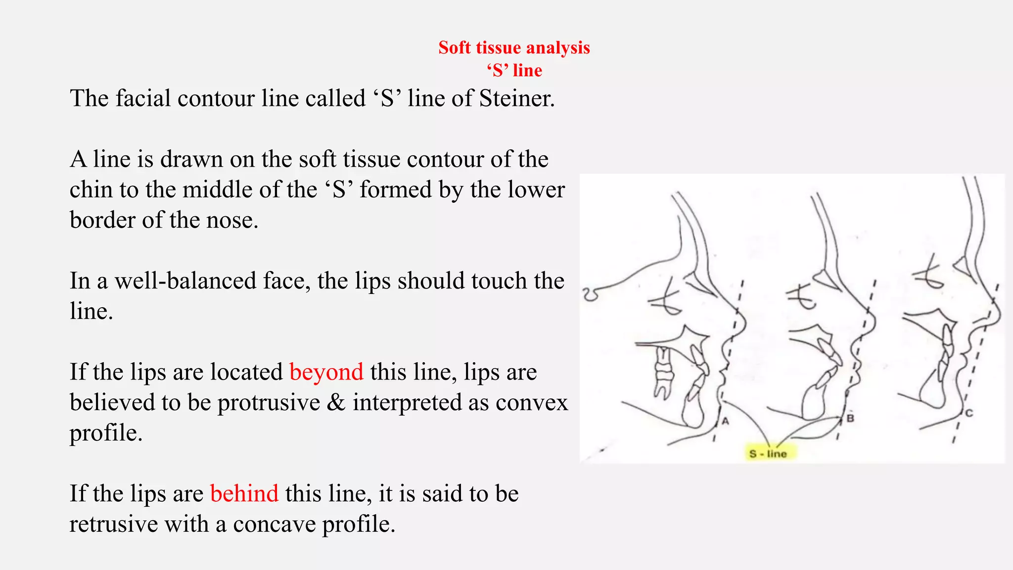 Steiner analysis in orthodontics (Nay Aung, PhD).pdf