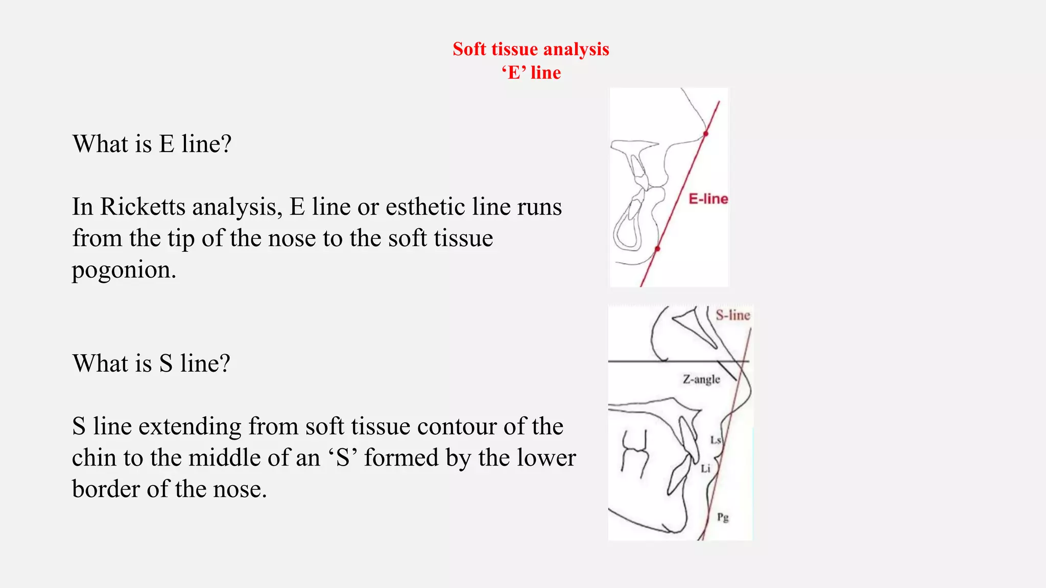 Steiner analysis in orthodontics (Nay Aung, PhD).pdf