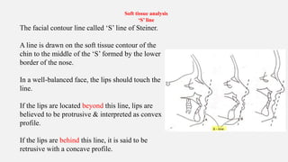 Steiner analysis in orthodontics (Nay Aung, PhD).pdf