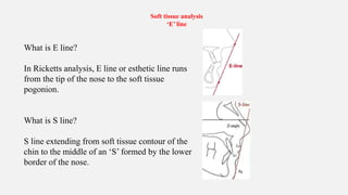 Steiner analysis in orthodontics (Nay Aung, PhD).pdf
