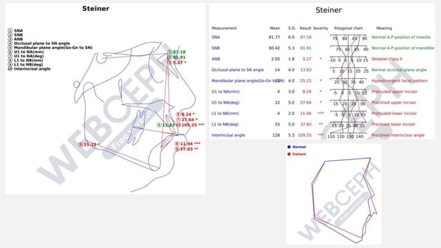 Steiner analysis in orthodontics (Nay Aung, PhD).pdf