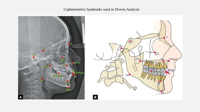 Steiner analysis in orthodontics (Nay Aung, PhD).pdf