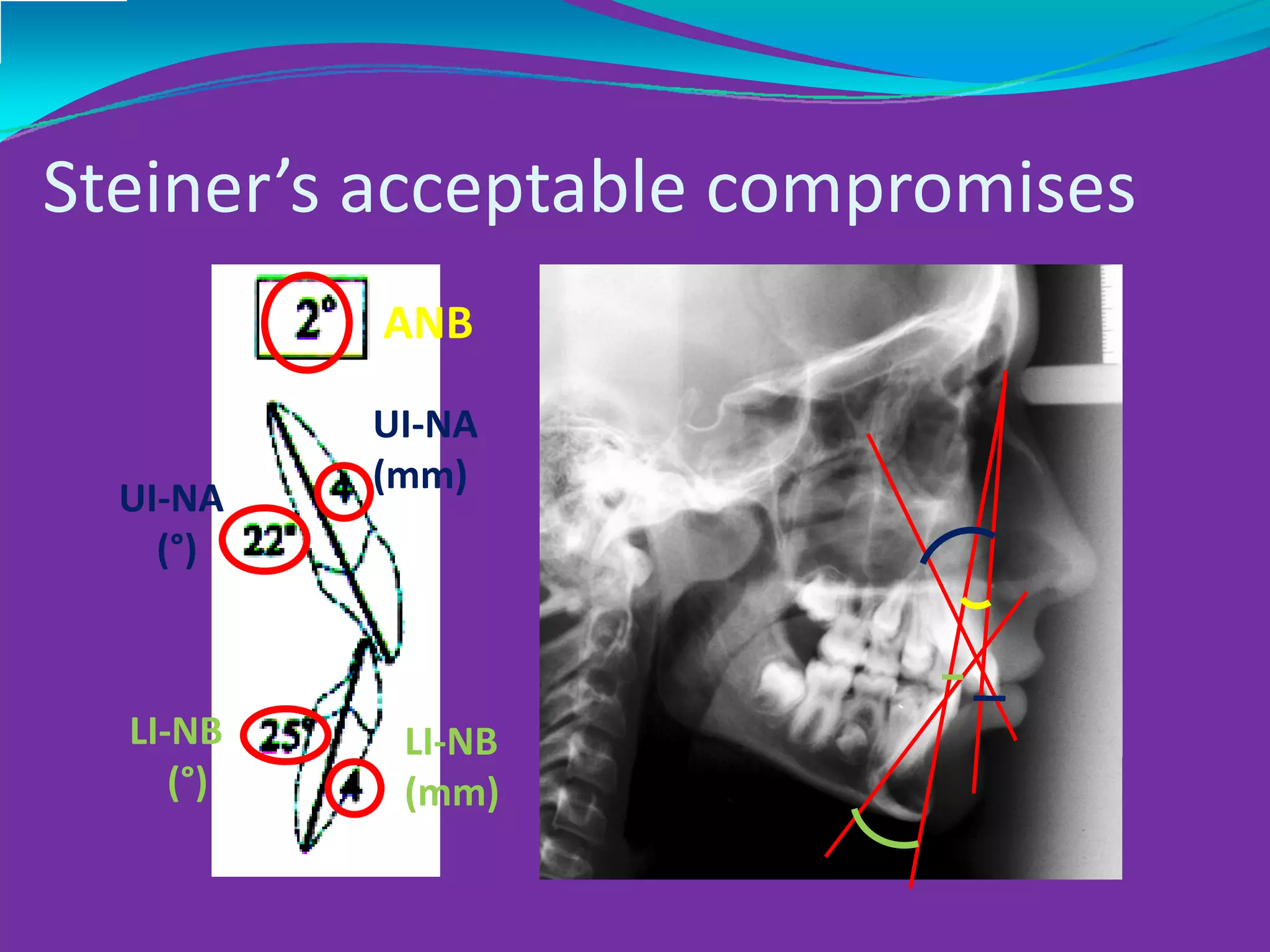 Steiner's Annalysis - Acceptable Deviation | PDF
