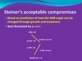 Steiner's Annalysis - Acceptable Deviation | PDF