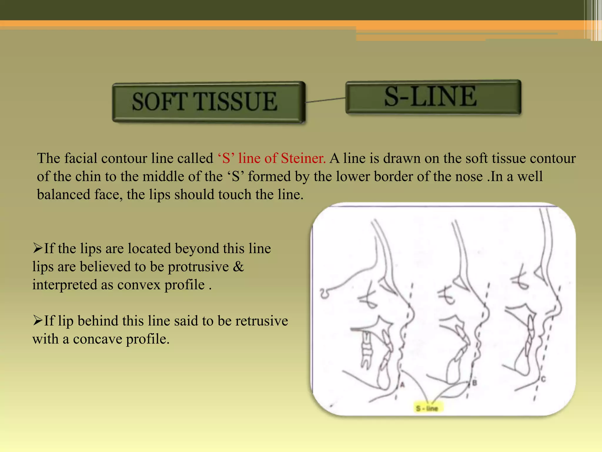 STEINERS ANALYSIS : CEPHALOMETRICS | PPTX