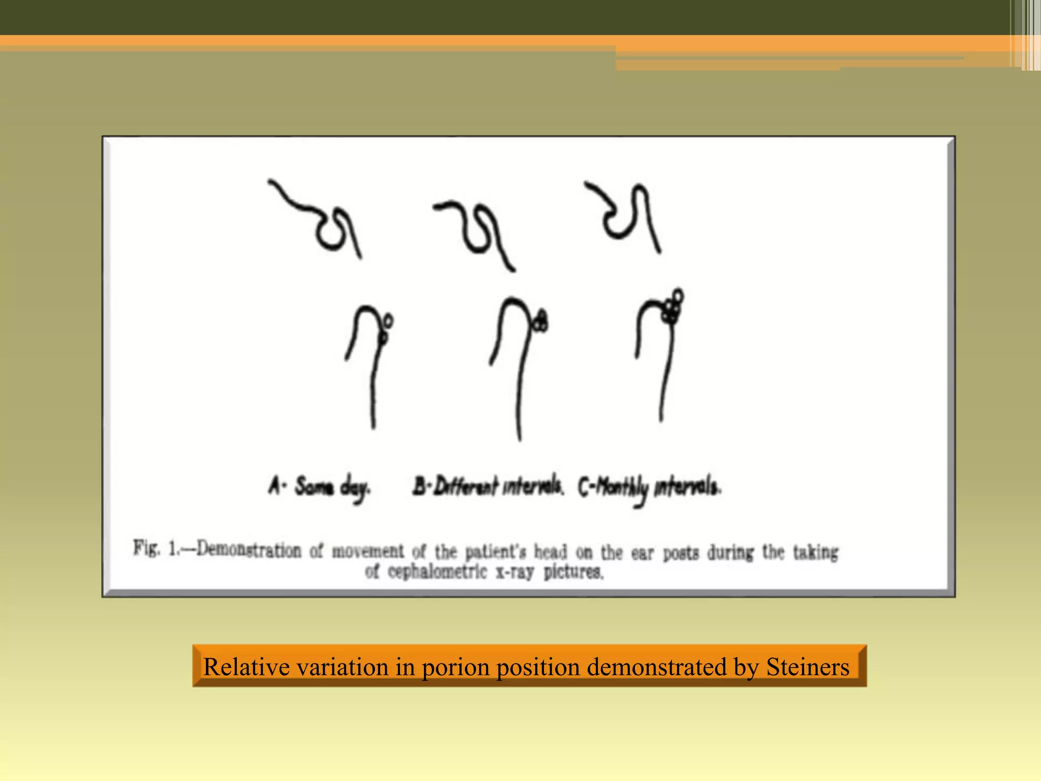 STEINERS ANALYSIS : CEPHALOMETRICS | PPTX