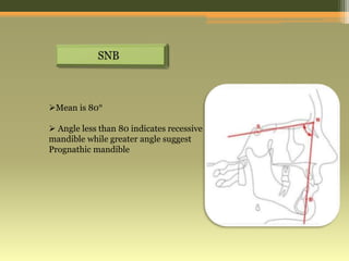 STEINERS ANALYSIS : CEPHALOMETRICS | PPTX