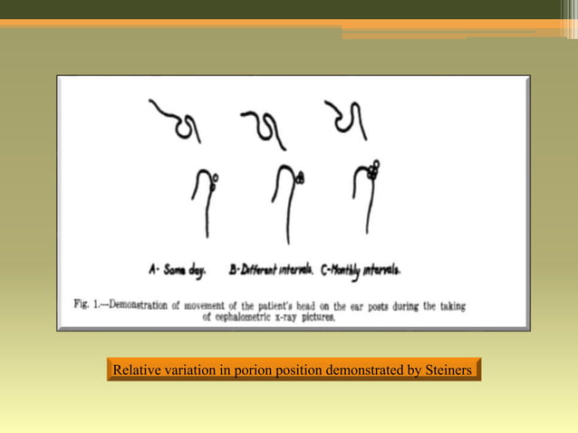 STEINERS ANALYSIS : CEPHALOMETRICS | PPTX | Dental Health | Diseases ...