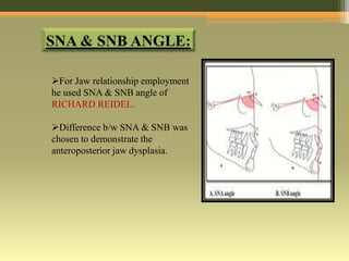 STEINERS ANALYSIS : CEPHALOMETRICS | PPTX