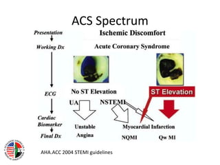 St elevation myocardial infarction | PDF