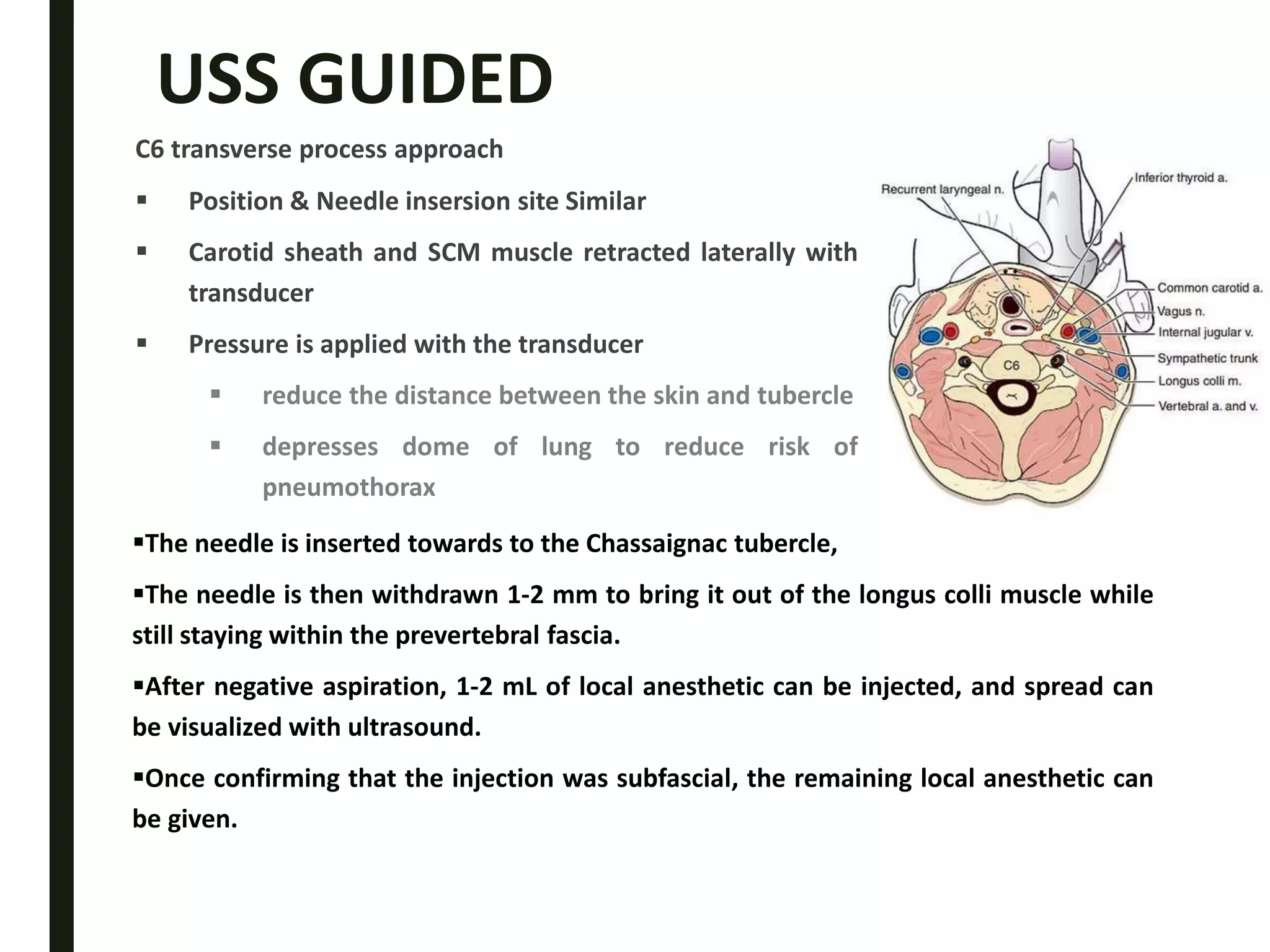 Stellate ganglion block | PPTX