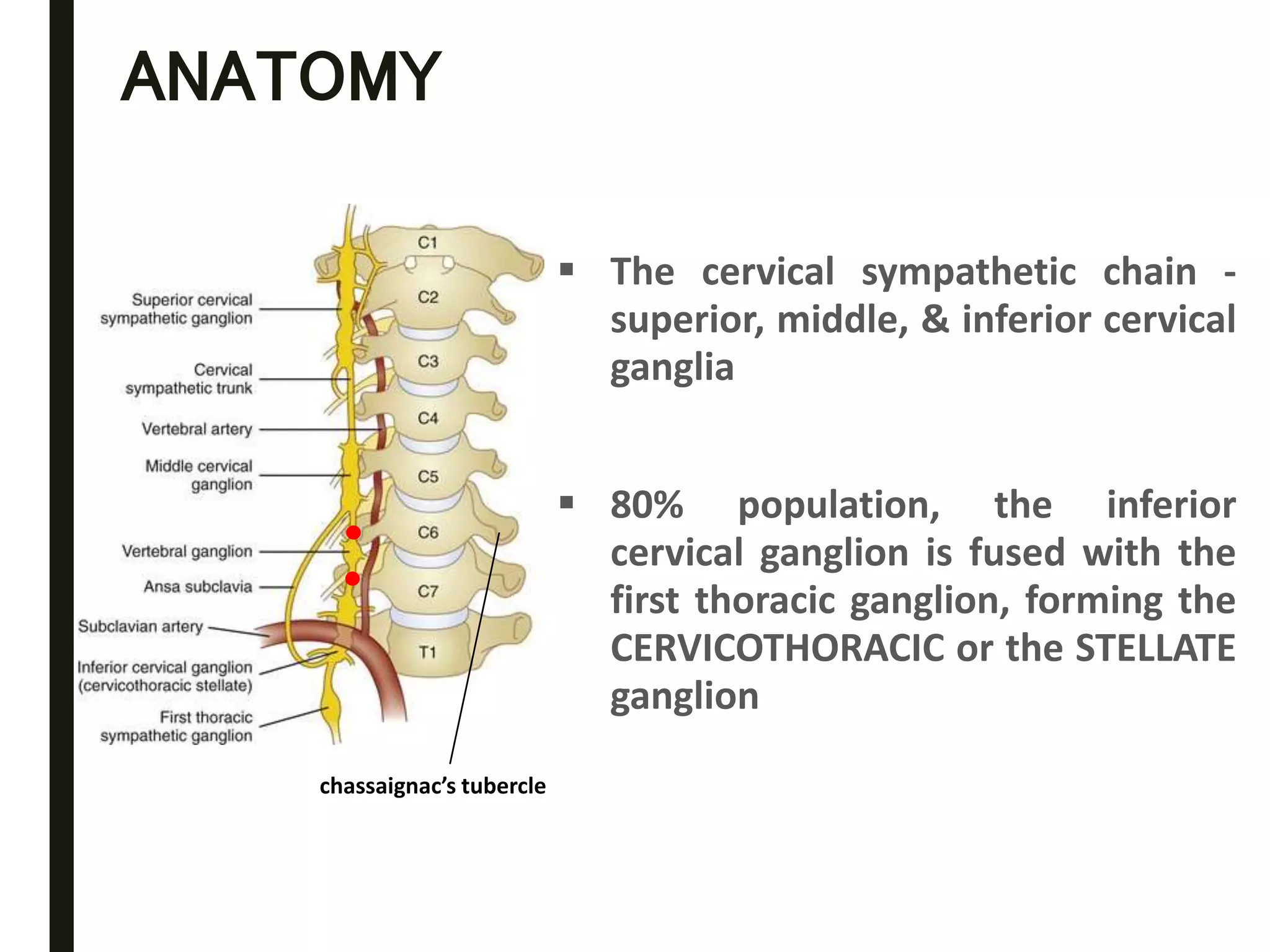 Stellate ganglion block | PPTX