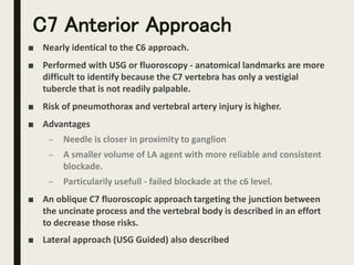 Stellate ganglion block | PPTX