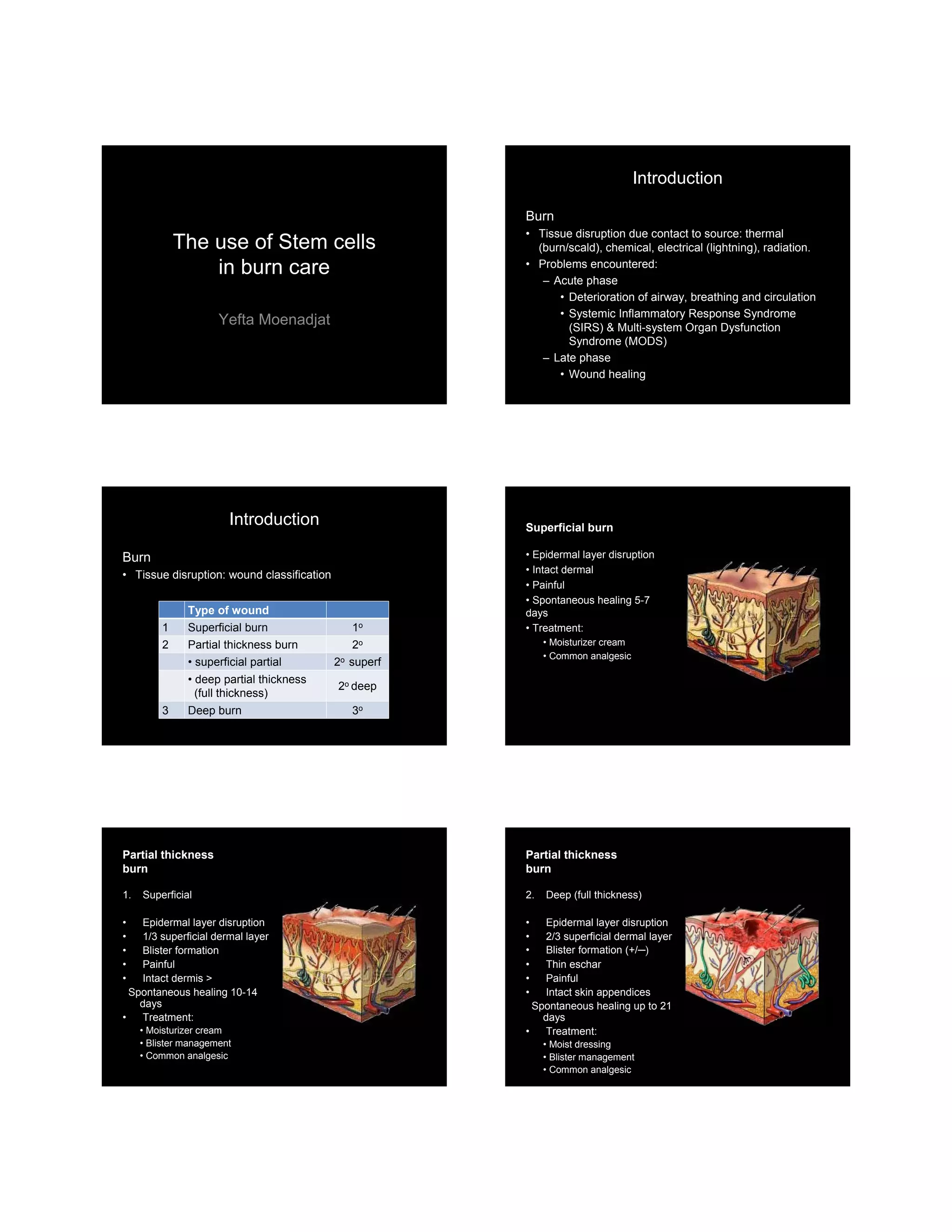 The use of Stem cells in burn care | PDF